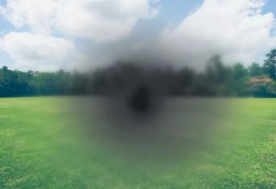 Traitement de la DMLA à Avignon | Ophtalmologue | CSO